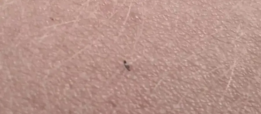 Bichitos del calor: invasión de bichitos que pican | Raza Folklorica!